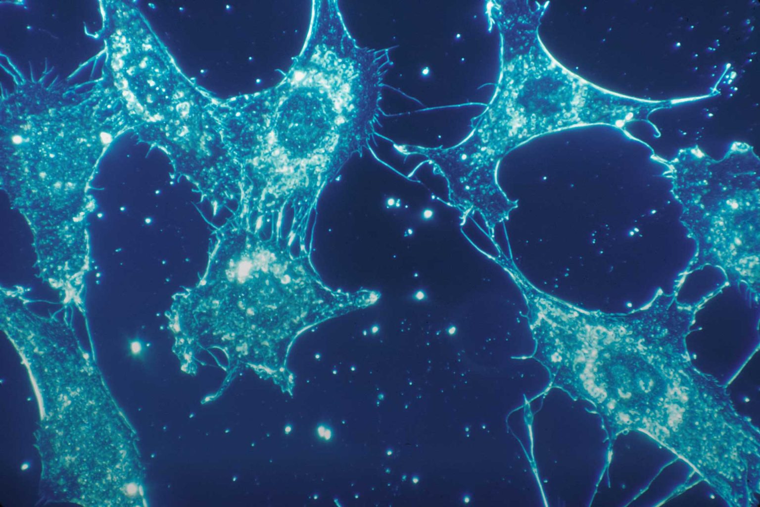 Cos'è il cancro? - Sbarro Health Research Organization